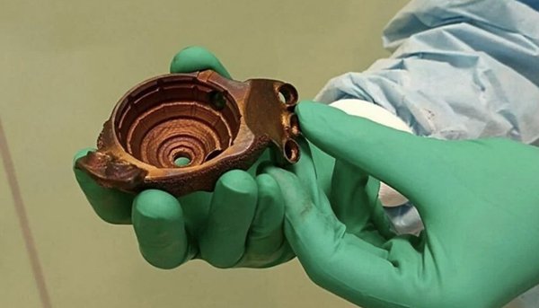 Polish hospital successfully implants 3D printed titanium alloy hip ...